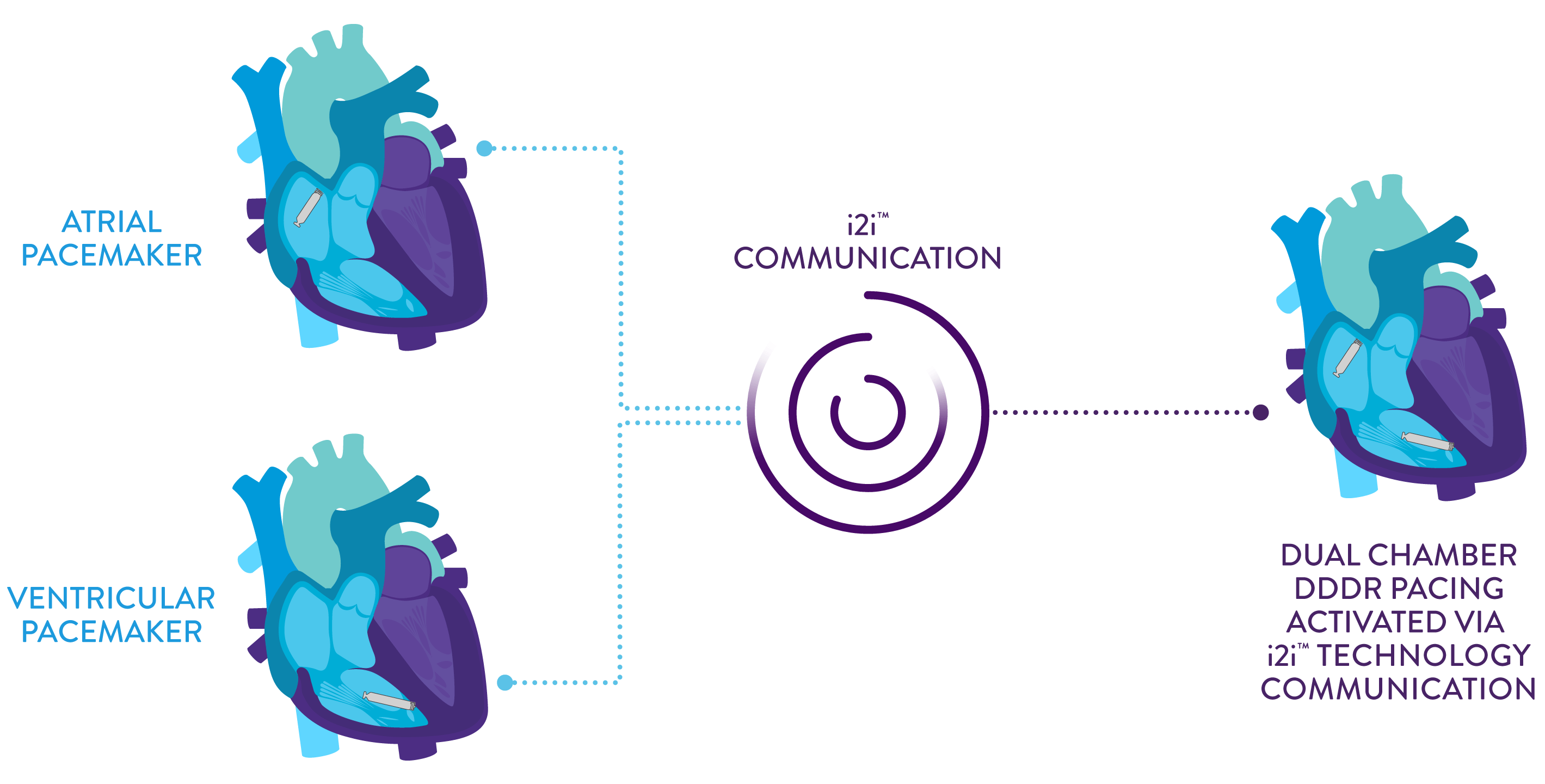 CRM HCP Blog - Dual Chamber Leadless Pacemaker FDA | Abbott